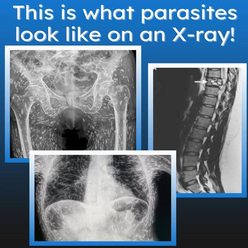 Parasites - Part 1 – Mr Vigour Supps